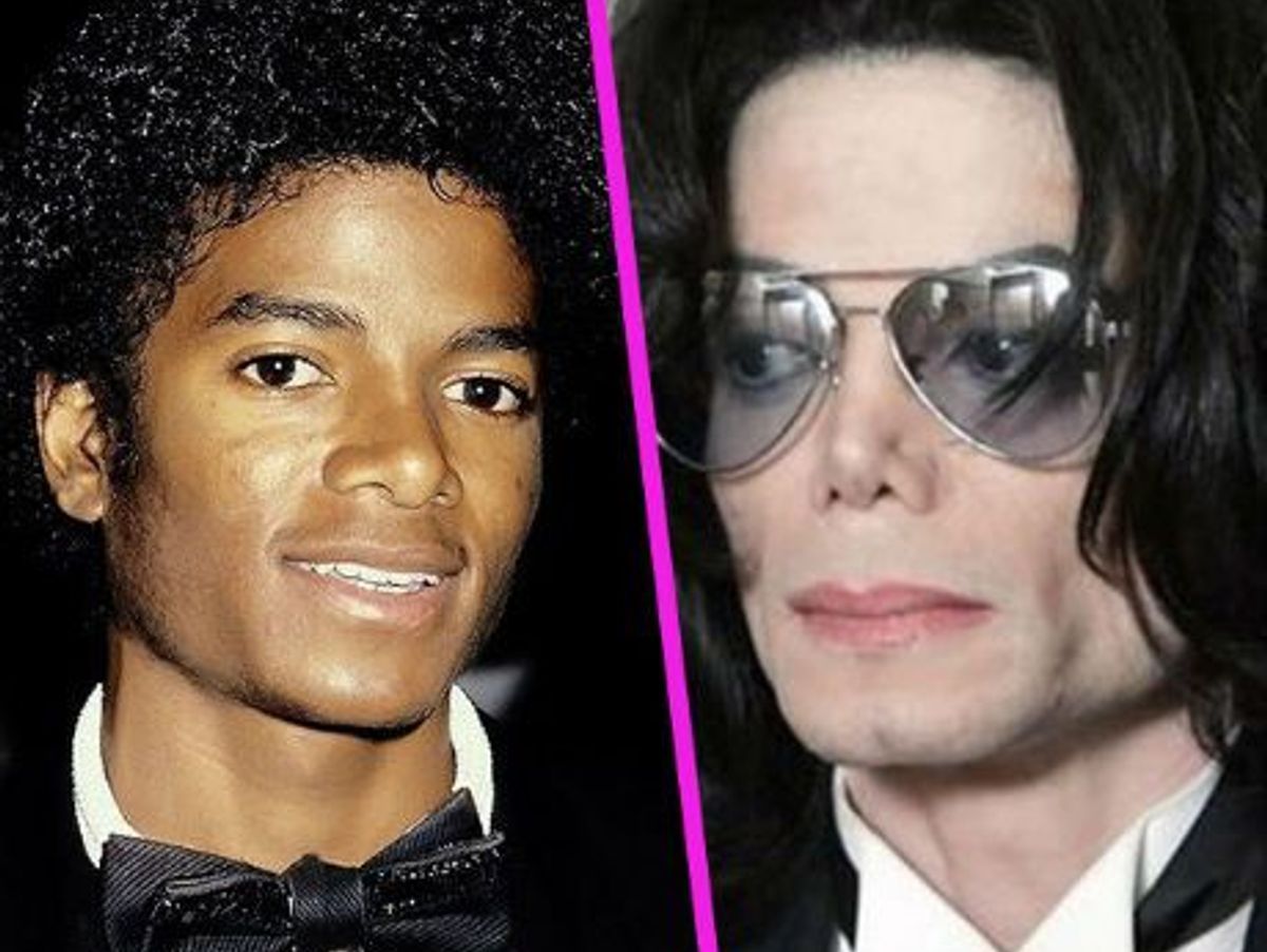 Michael Jackson accro à la chirurgie esthétique - Conte beaute Turquie